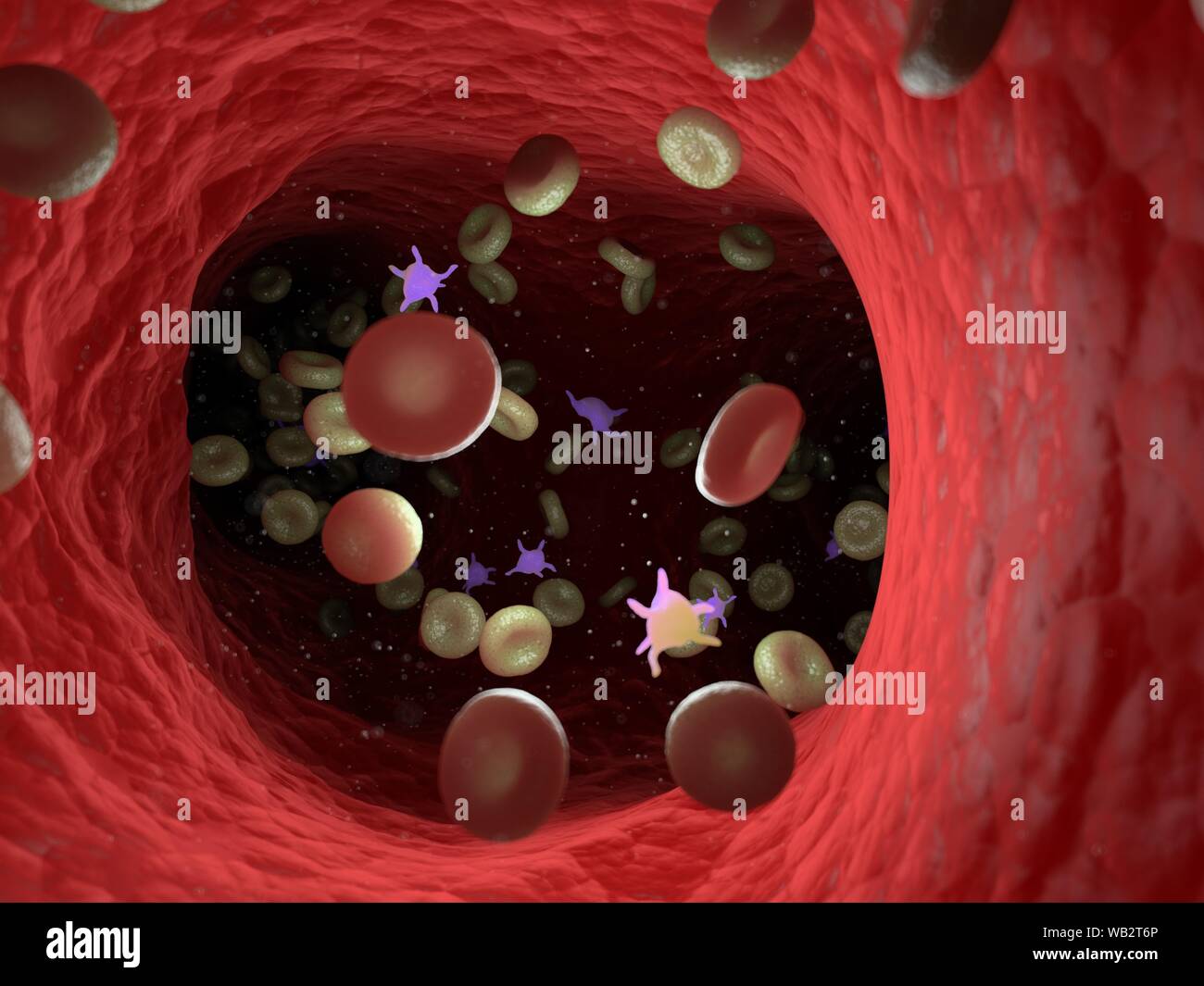 Diseased blood cells, computer illustration Stock Photo - Alamy