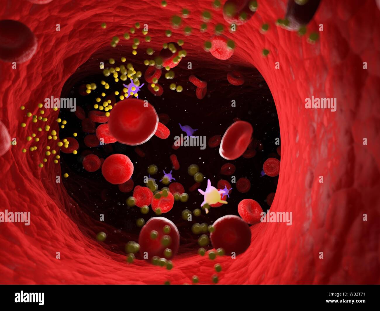 Fat in blood vessels, computer illustration Stock Photo - Alamy