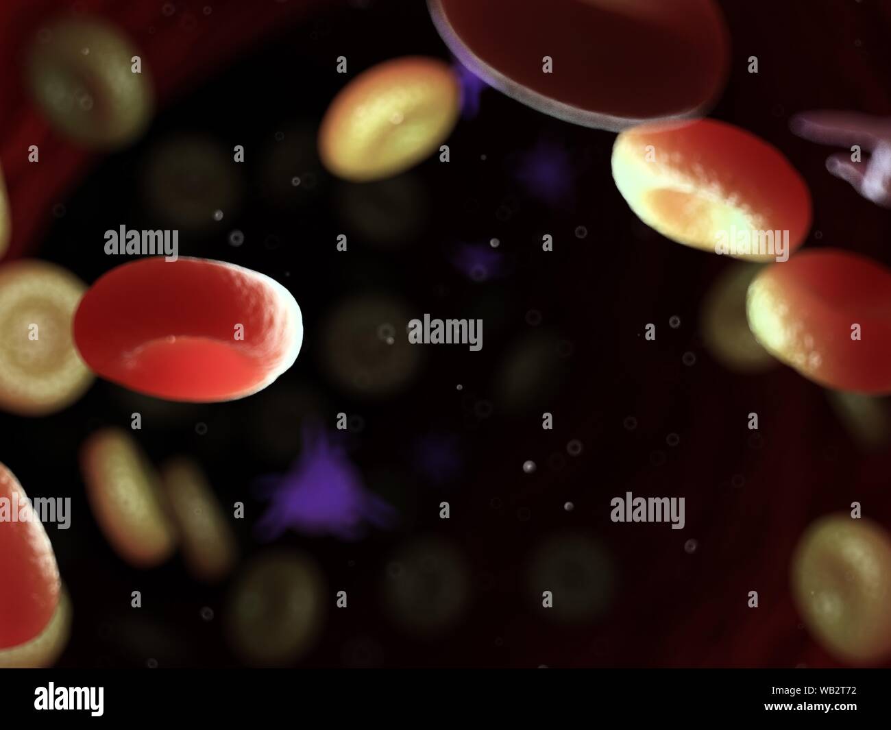 Diseased blood cells, computer illustration Stock Photo - Alamy