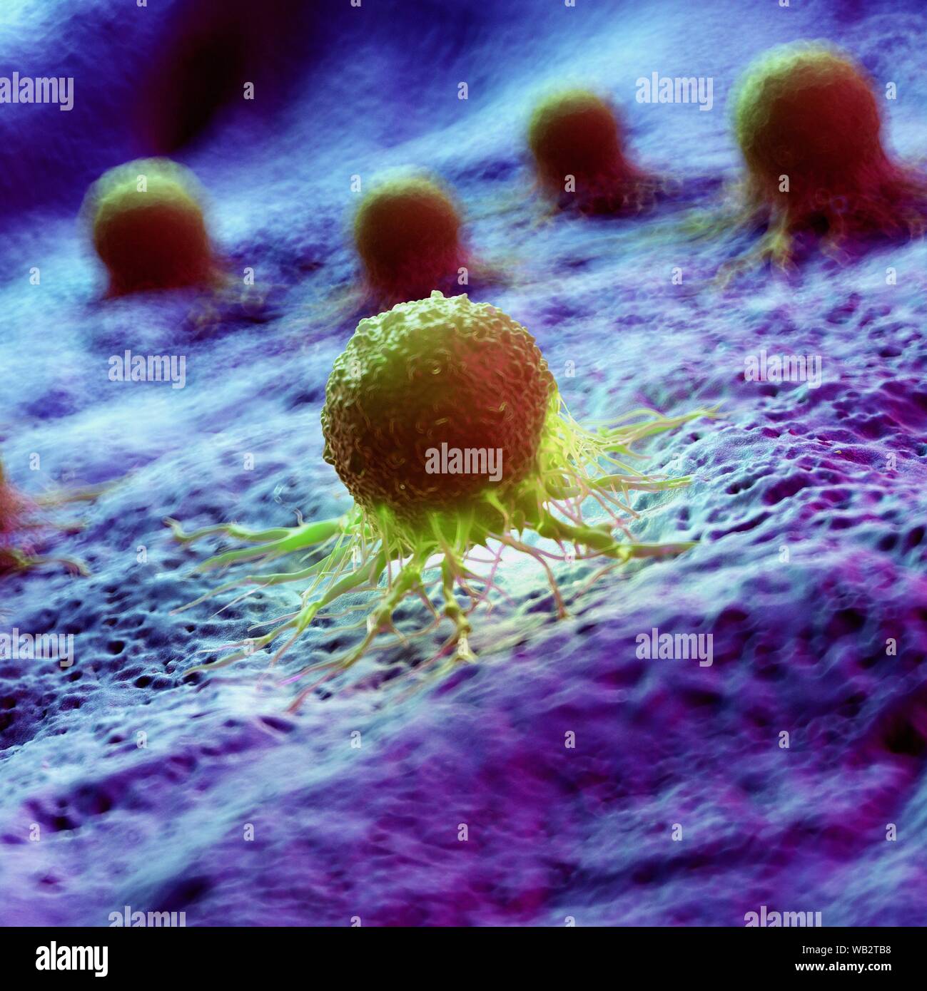 Cancer cells, computer illustration Stock Photo - Alamy