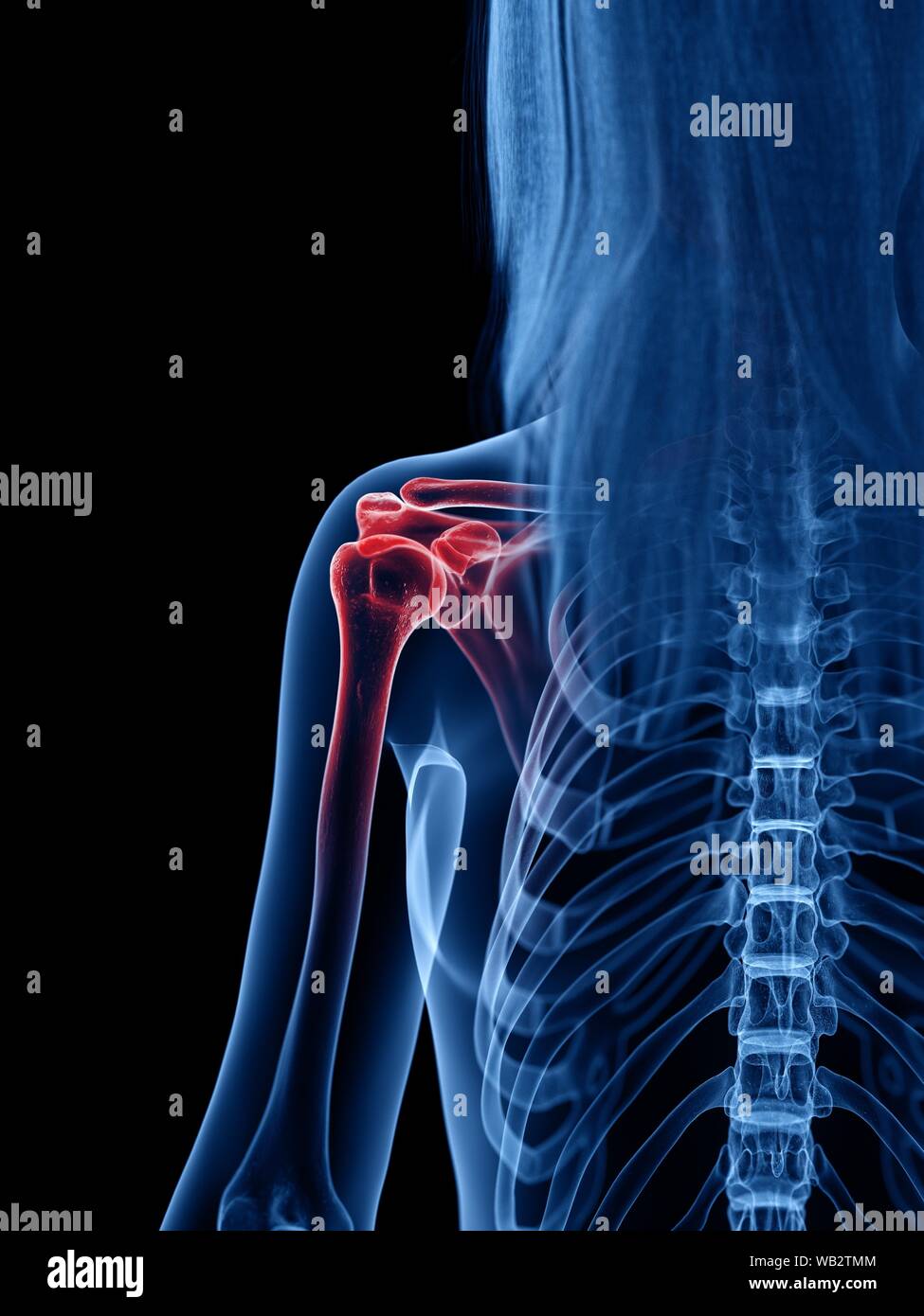 Shoulder pain, conceptual illustration Stock Photo - Alamy