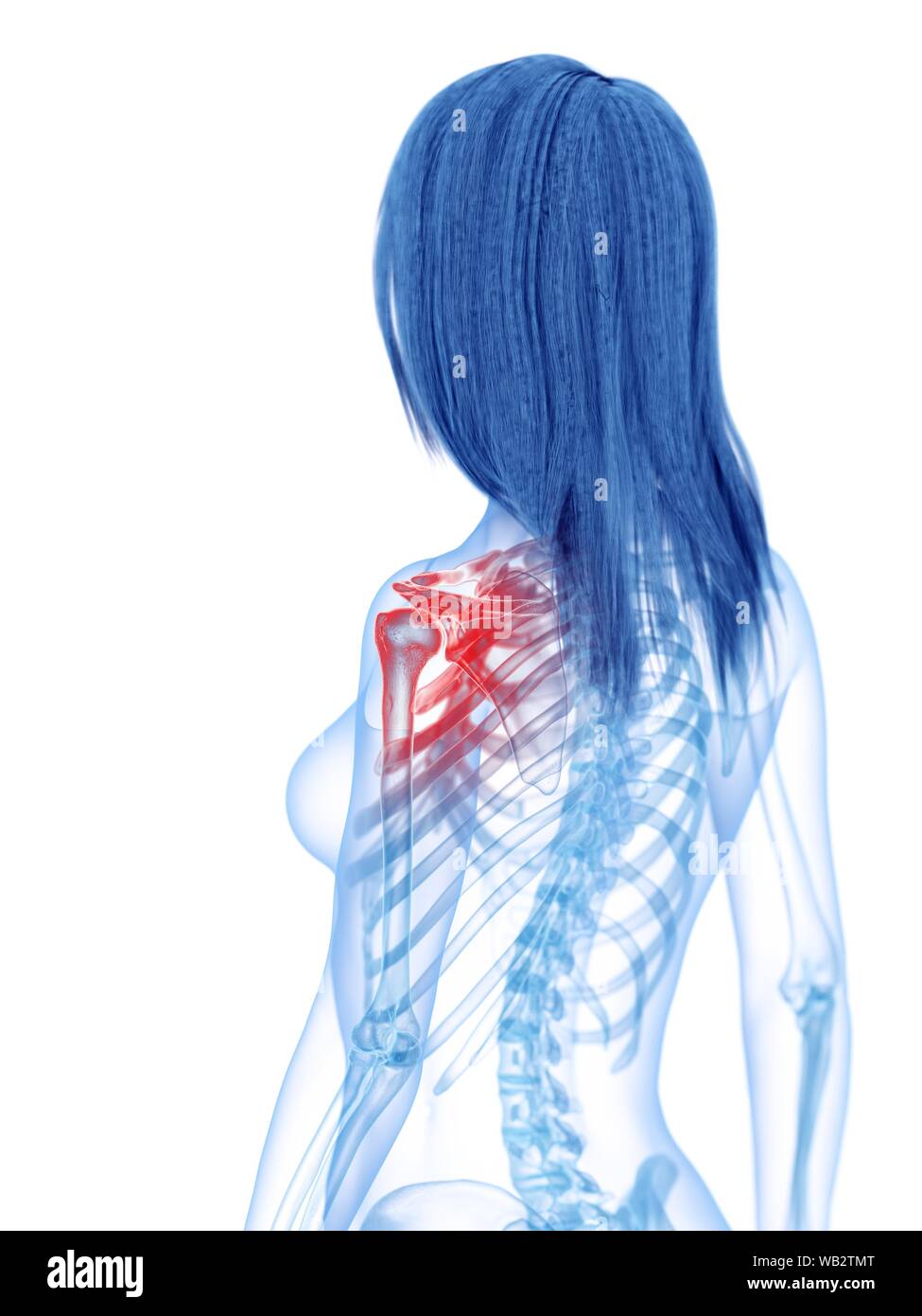 Shoulder pain, conceptual illustration Stock Photo - Alamy Shoulder pain, conceptual illustration Stock Photo - Alamy