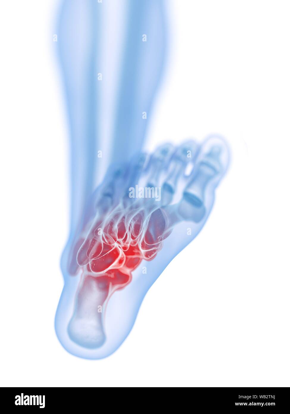 Articular pain hi-res stock photography and images - Alamy