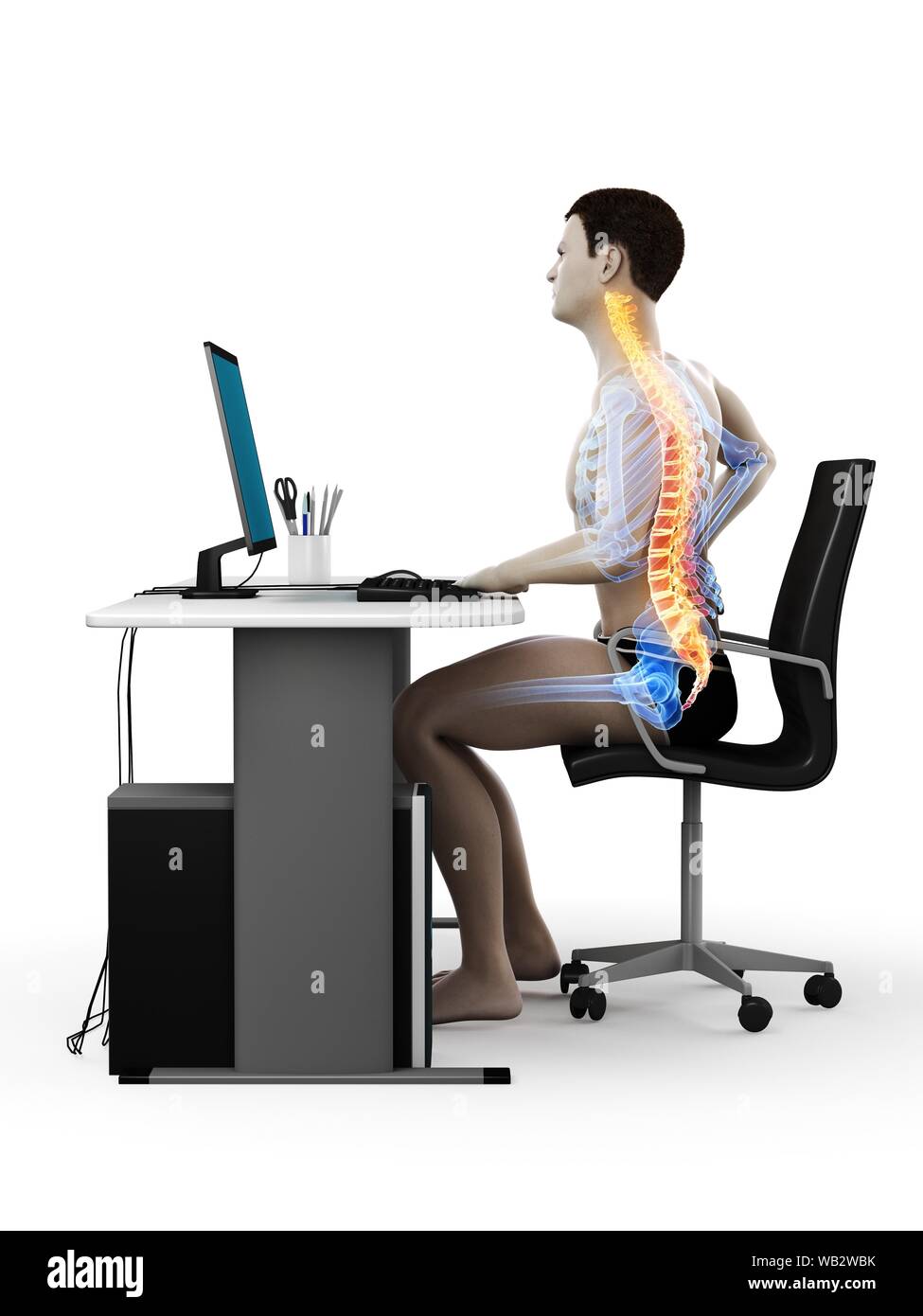 Office worker with back pain, conceptual illustration Stock Photo - Alamy