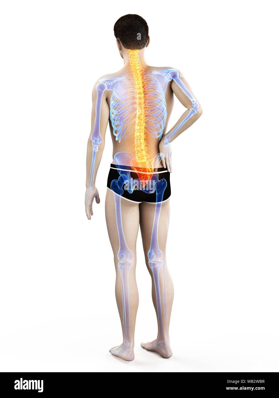 Back pain, conceptual illustration Stock Photo - Alamy