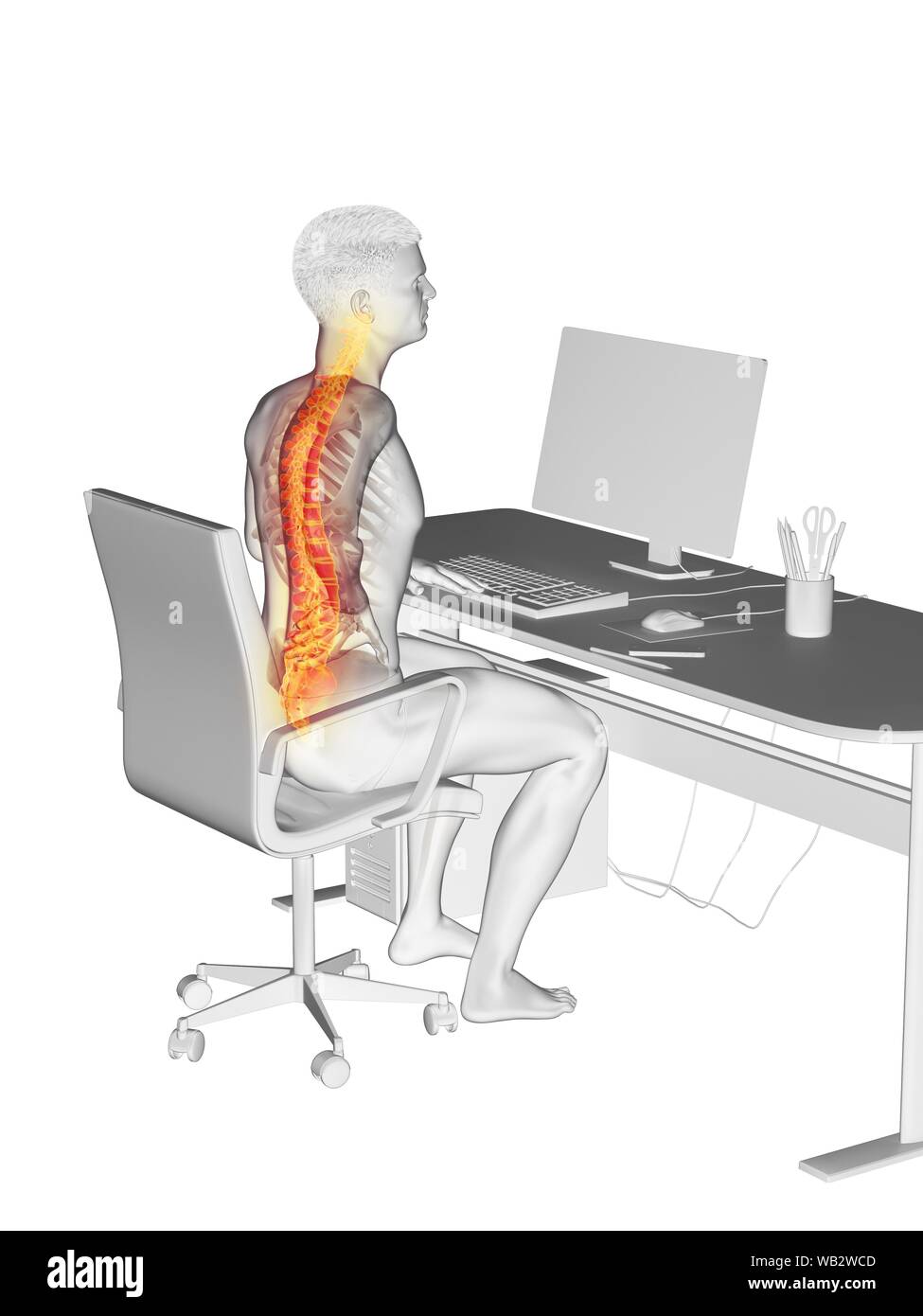 Office worker with back pain, conceptual illustration Stock Photo - Alamy