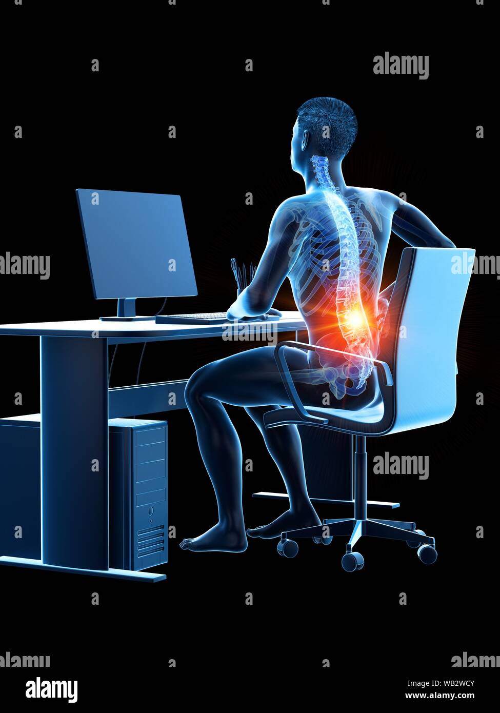Office worker with back pain, conceptual illustration Stock Photo - Alamy