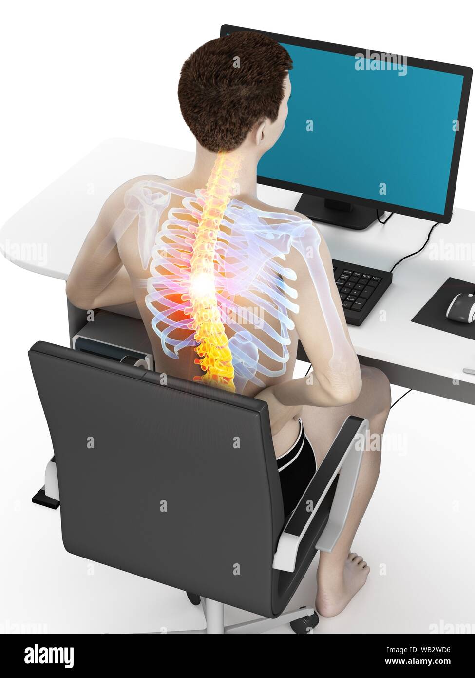 Office worker with back pain, conceptual illustration Stock Photo - Alamy