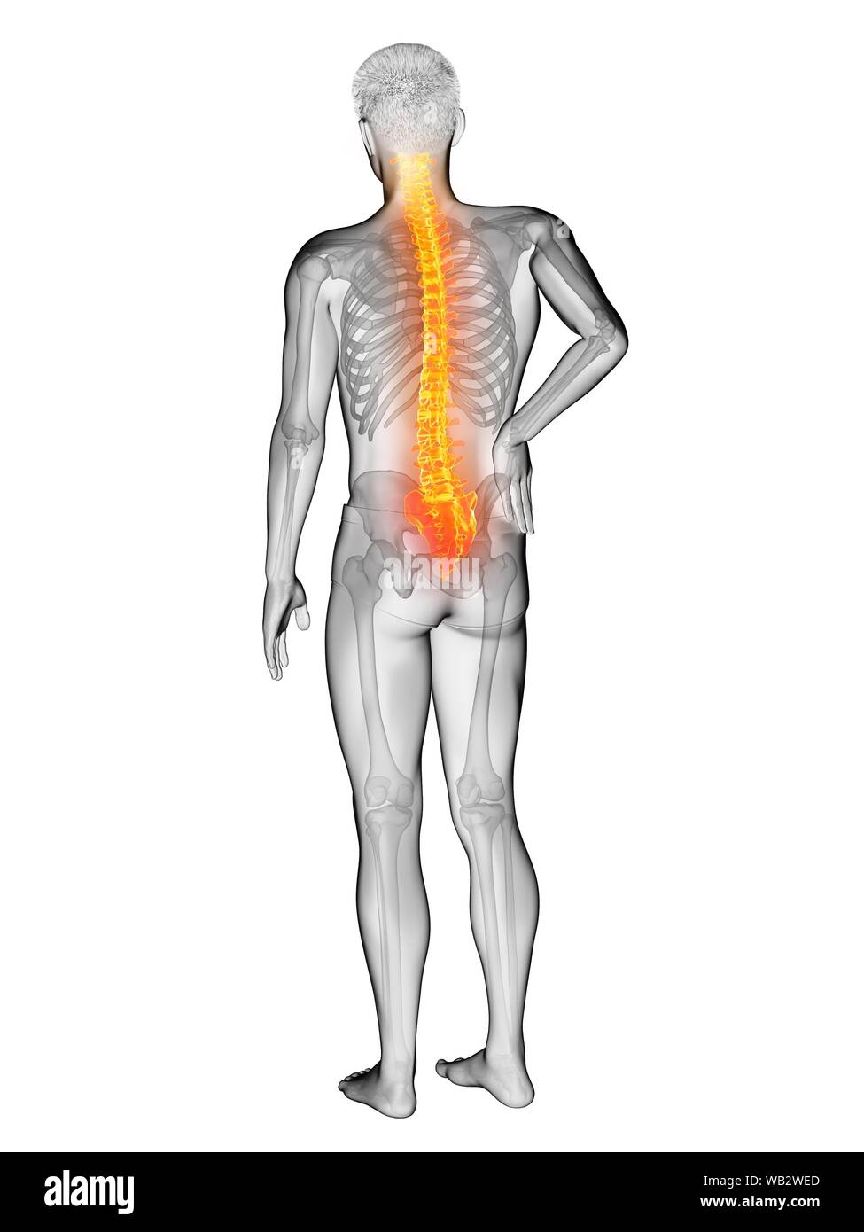Back pain, conceptual illustration Stock Photo - Alamy