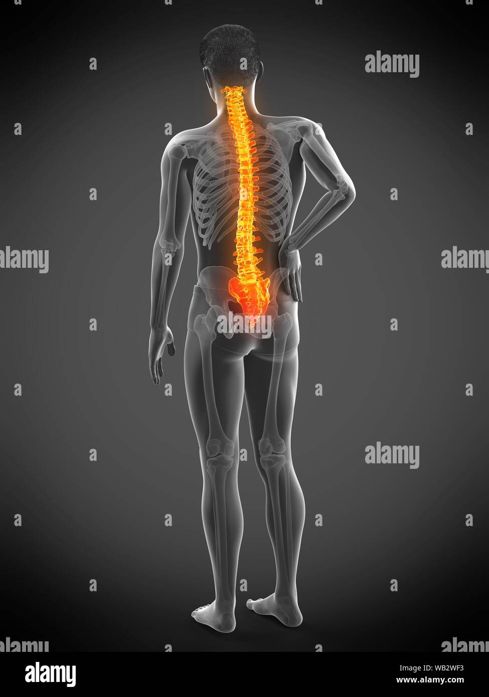 Back pain, conceptual illustration Stock Photo - Alamy