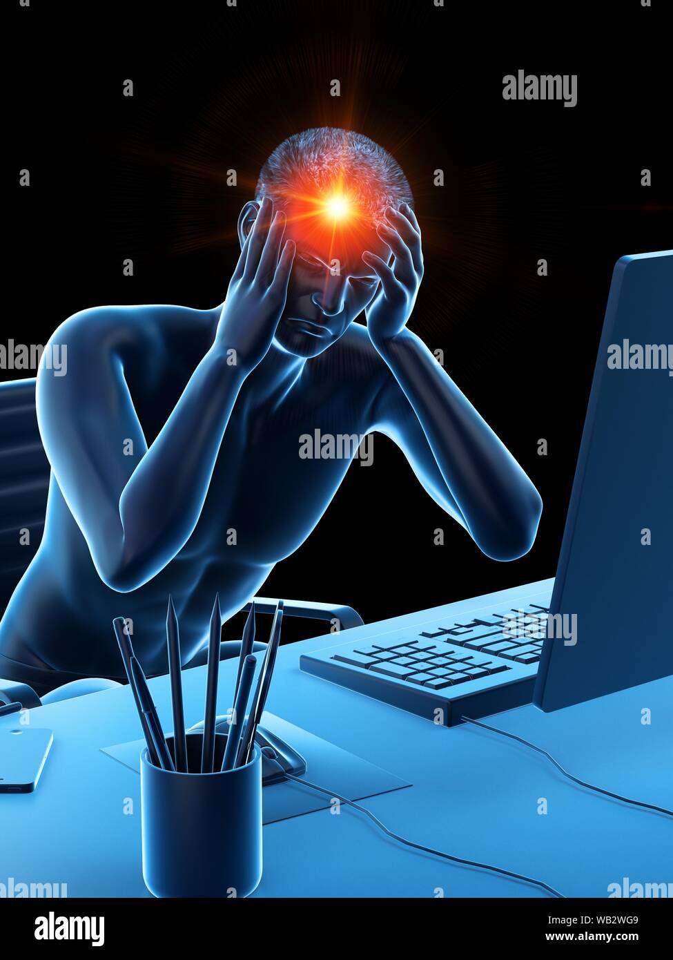 Office worker with headache, conceptual illustration Stock Photo - Alamy