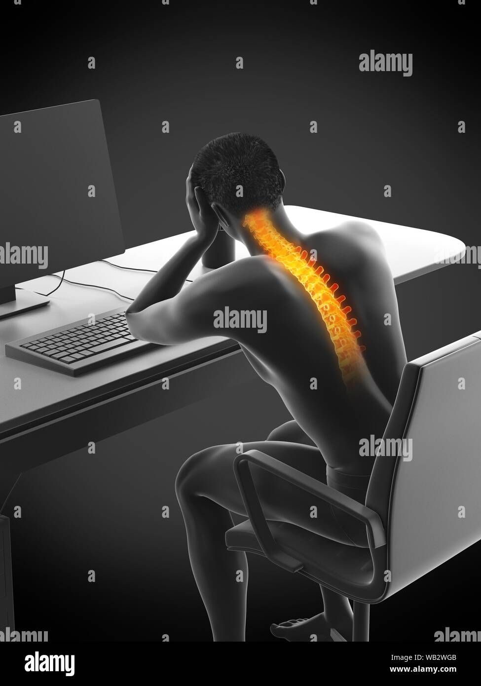 Office worker with back pain, conceptual illustration Stock Photo - Alamy