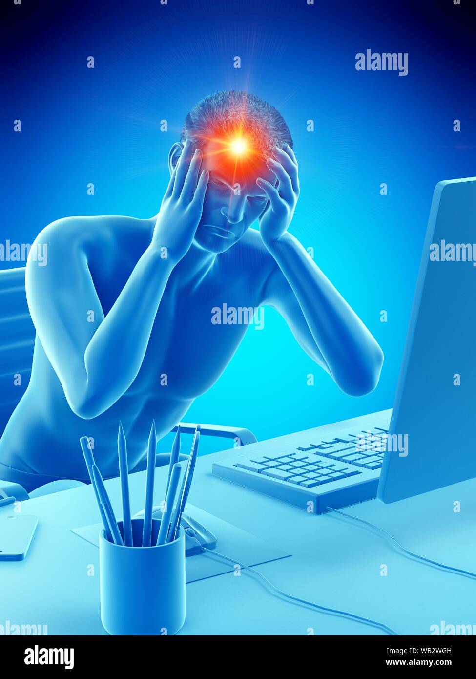 Office worker with headache, conceptual illustration Stock Photo - Alamy
