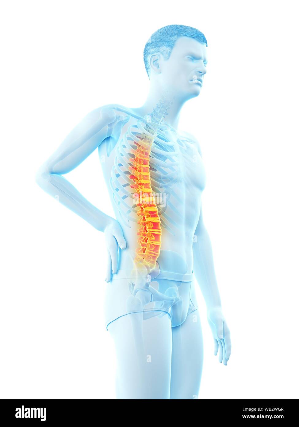 Back pain, conceptual illustration Stock Photo - Alamy