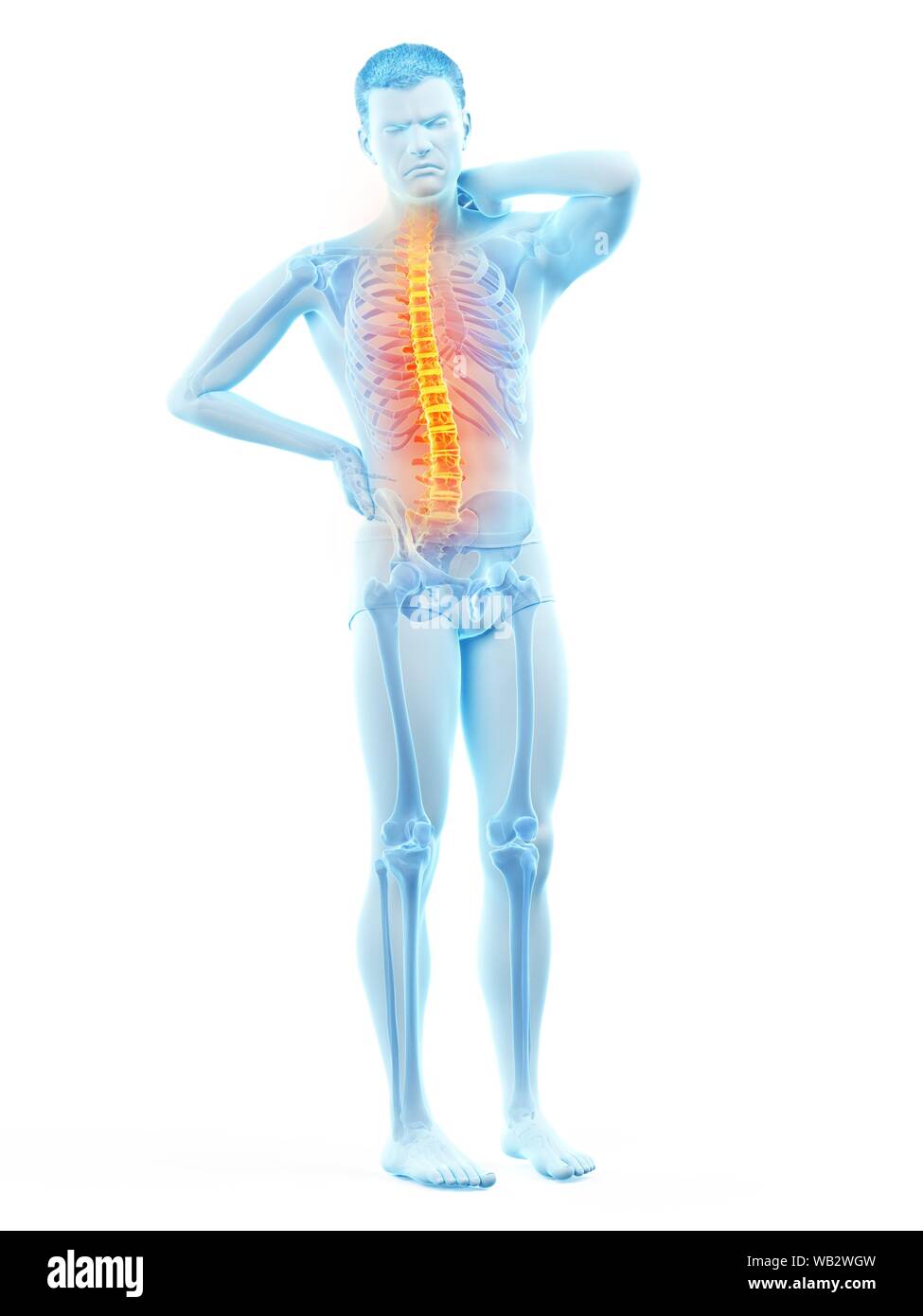 Back pain, conceptual illustration Stock Photo - Alamy