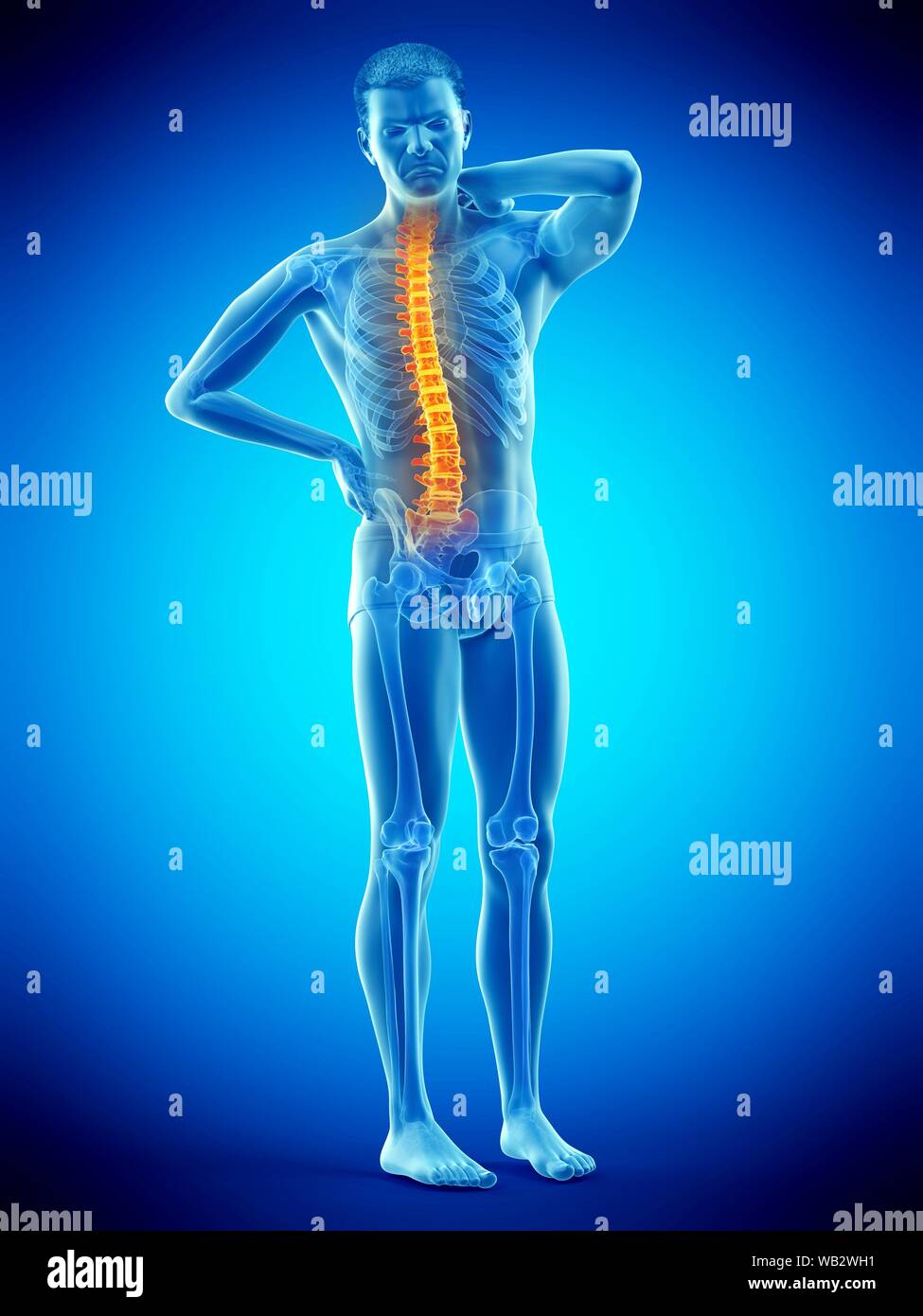 Back pain, conceptual illustration Stock Photo - Alamy