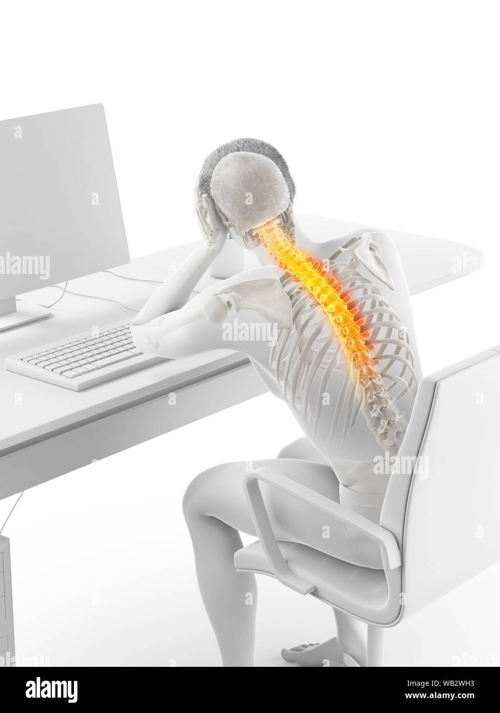 Office worker with back pain, conceptual illustration Stock Photo - Alamy