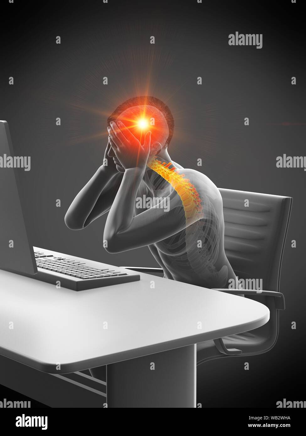 Office worker with headache, conceptual illustration Stock Photo - Alamy