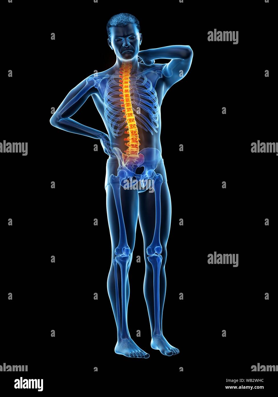 Back pain, conceptual illustration Stock Photo - Alamy