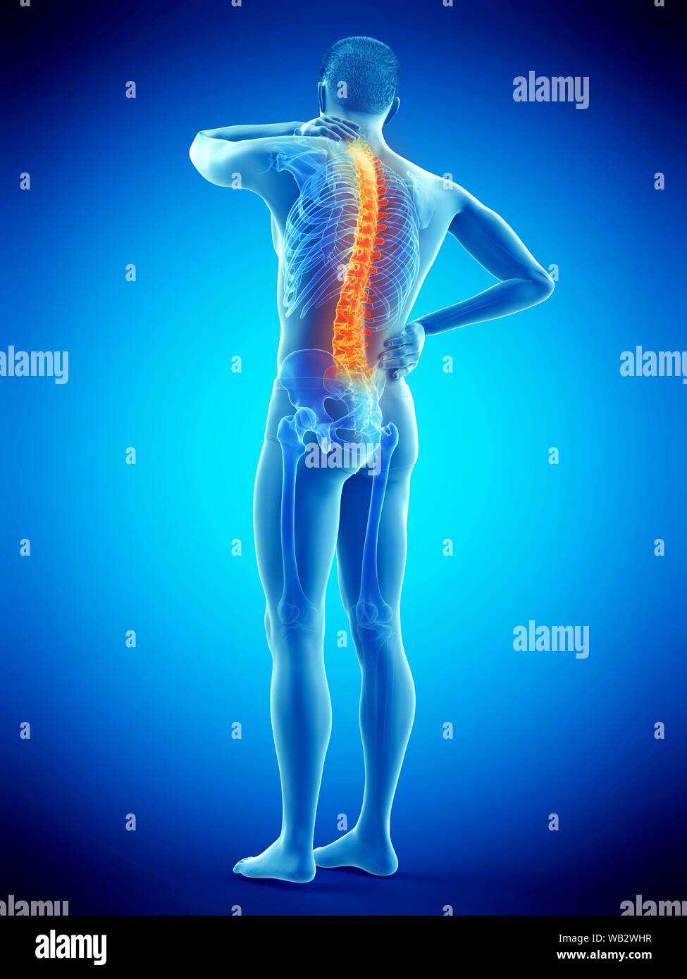 Back pain, conceptual illustration Stock Photo - Alamy