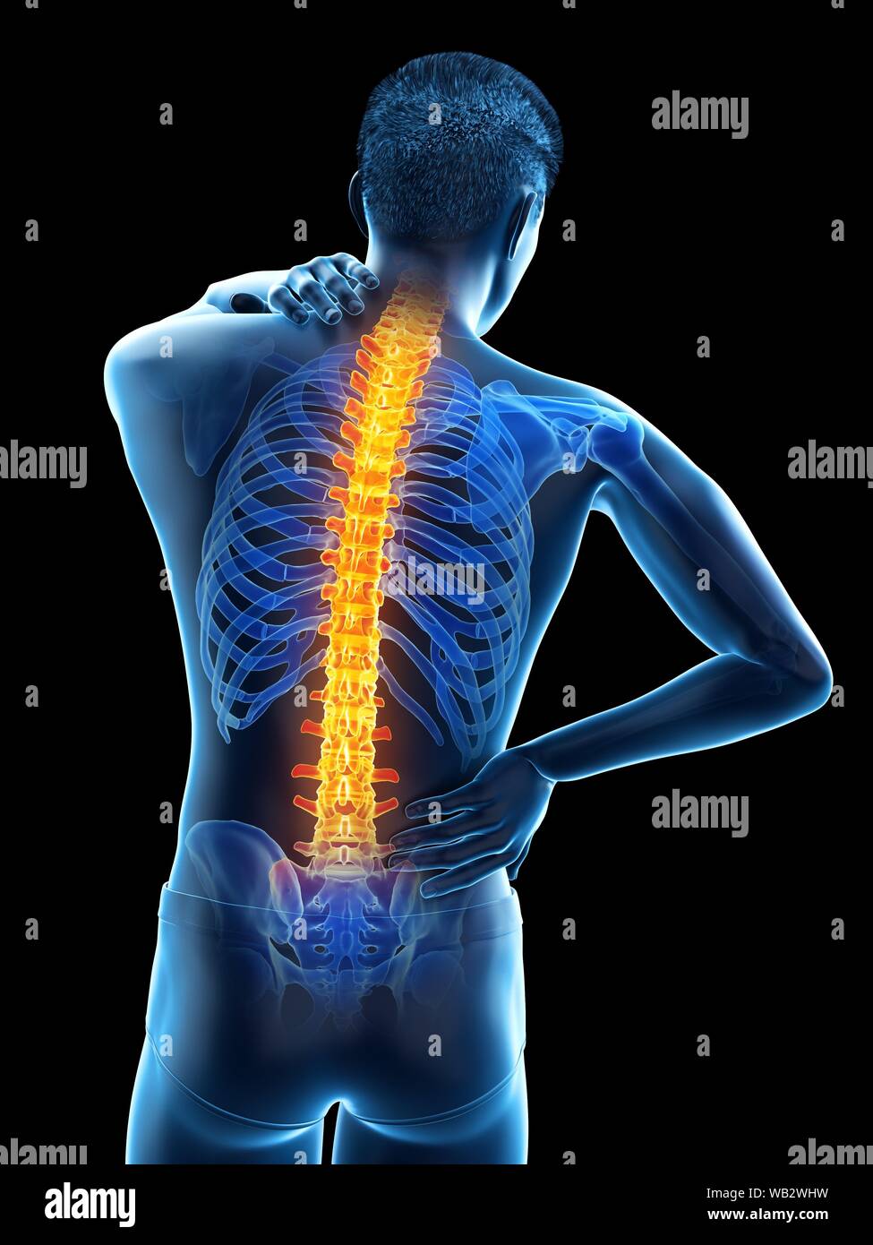 Back pain, conceptual illustration Stock Photo - Alamy