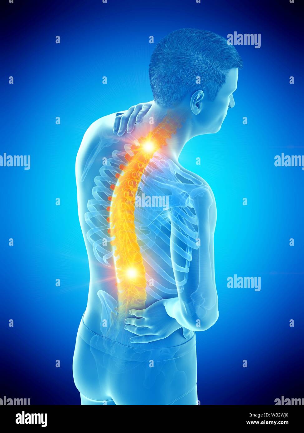 Back pain, conceptual illustration Stock Photo - Alamy