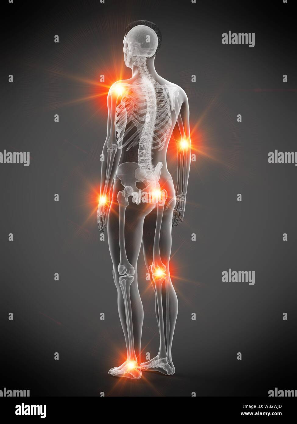 Joint pain, conceptual illustration Stock Photo - Alamy