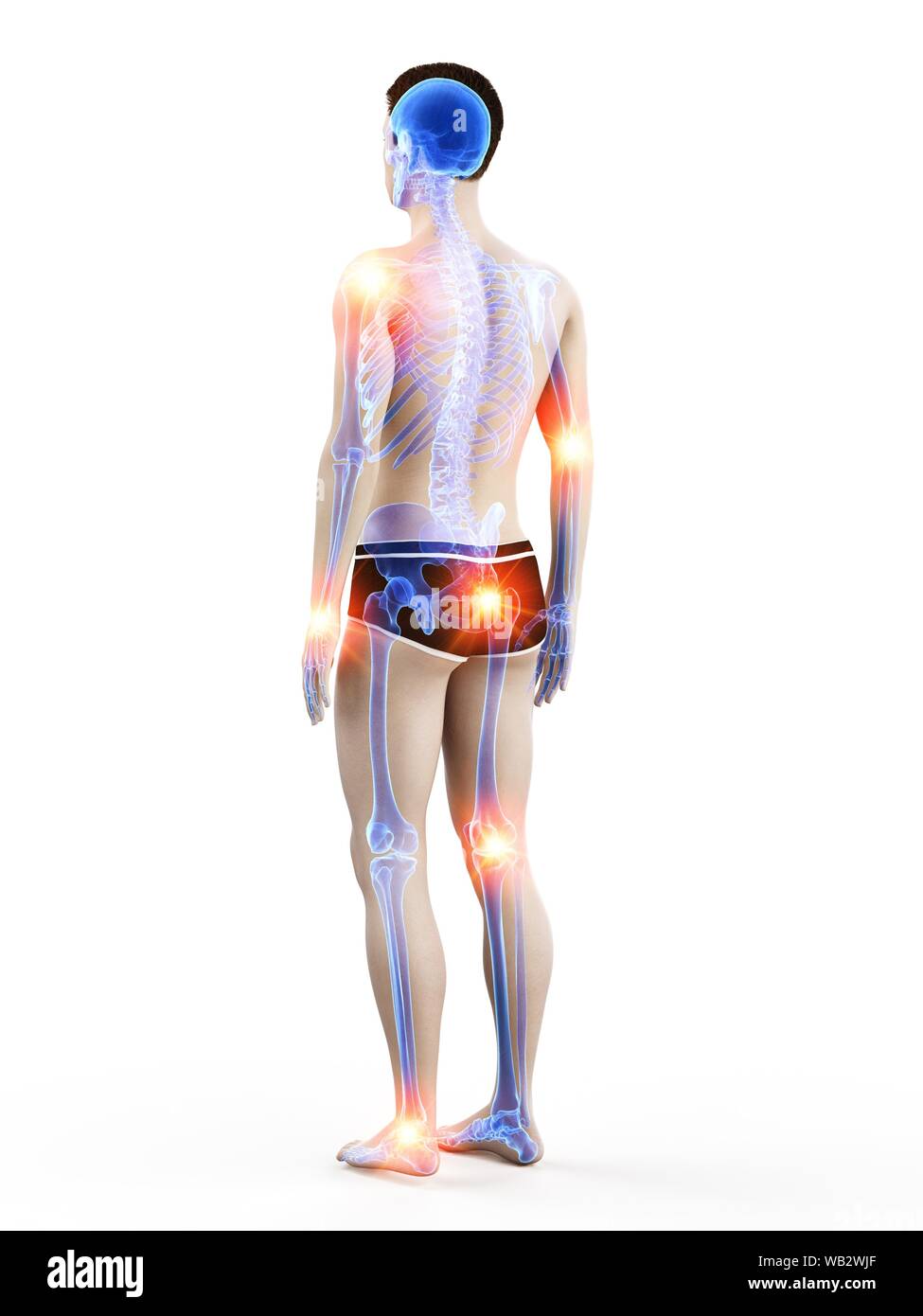 Painful shoulder joint illustration Cut Out Stock Images & Pictures - Alamy