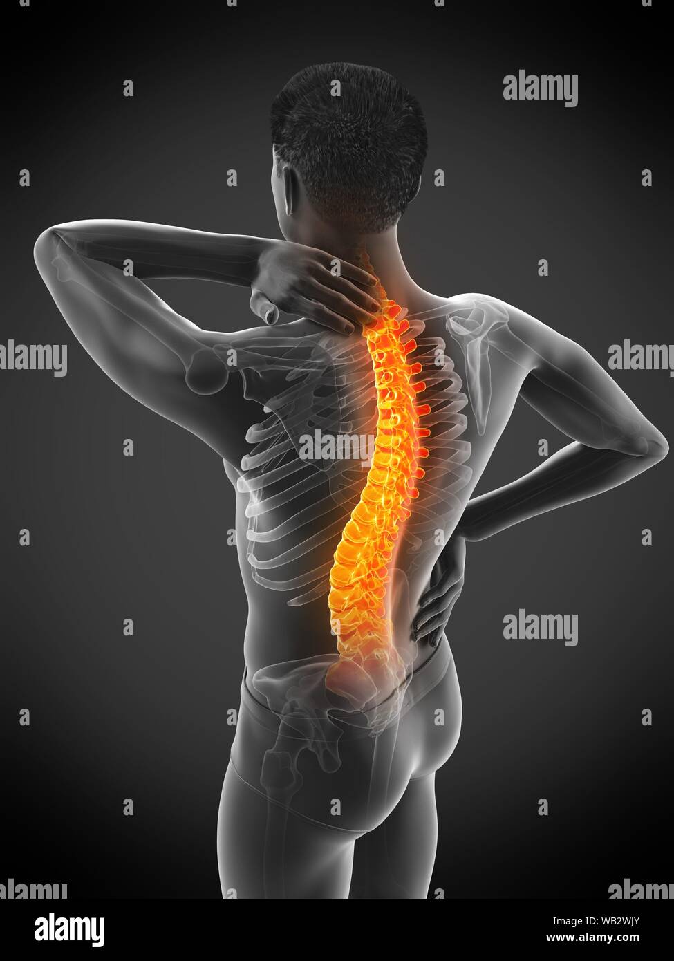 Back pain, conceptual illustration Stock Photo - Alamy