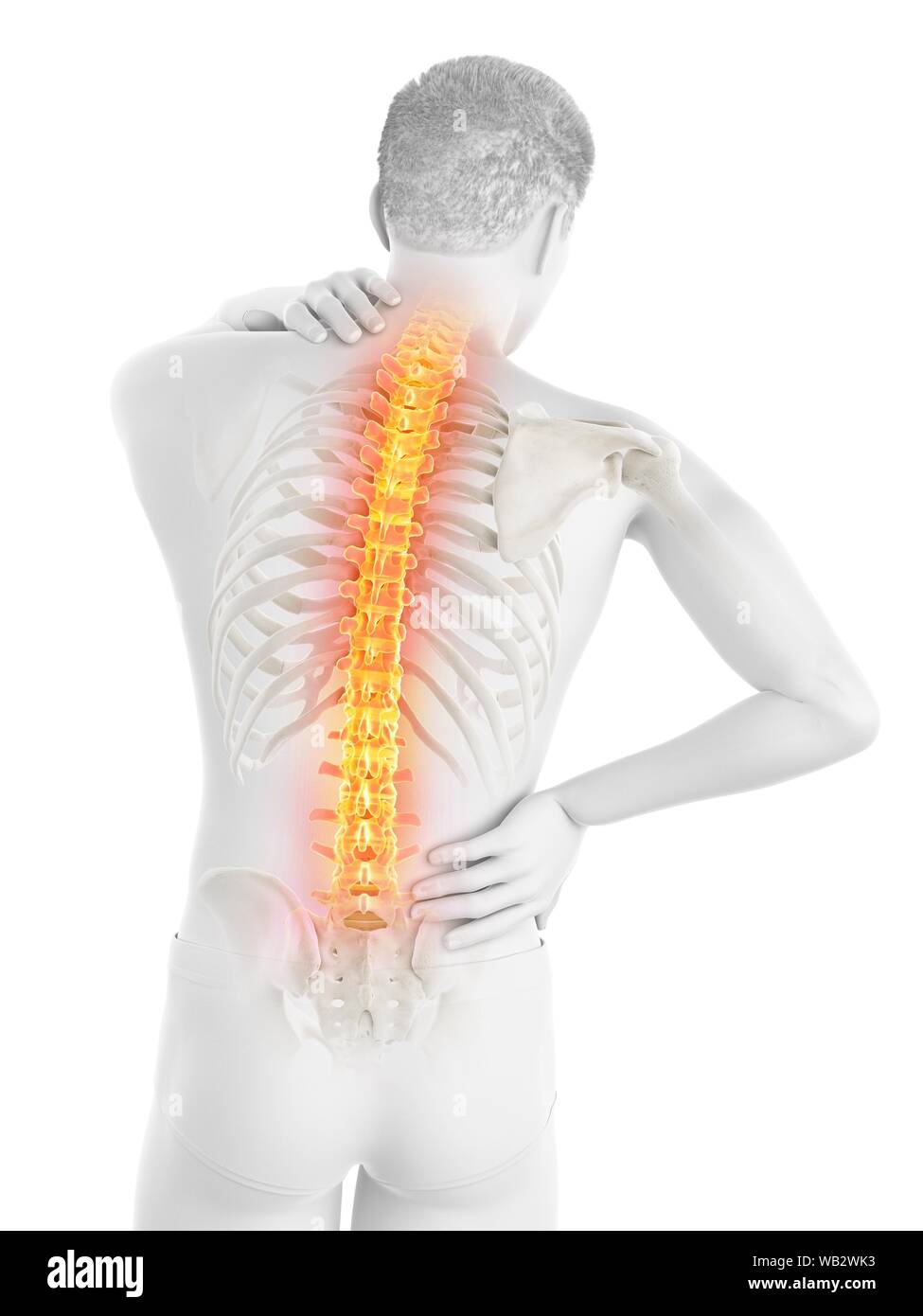 Back pain, conceptual illustration Stock Photo - Alamy