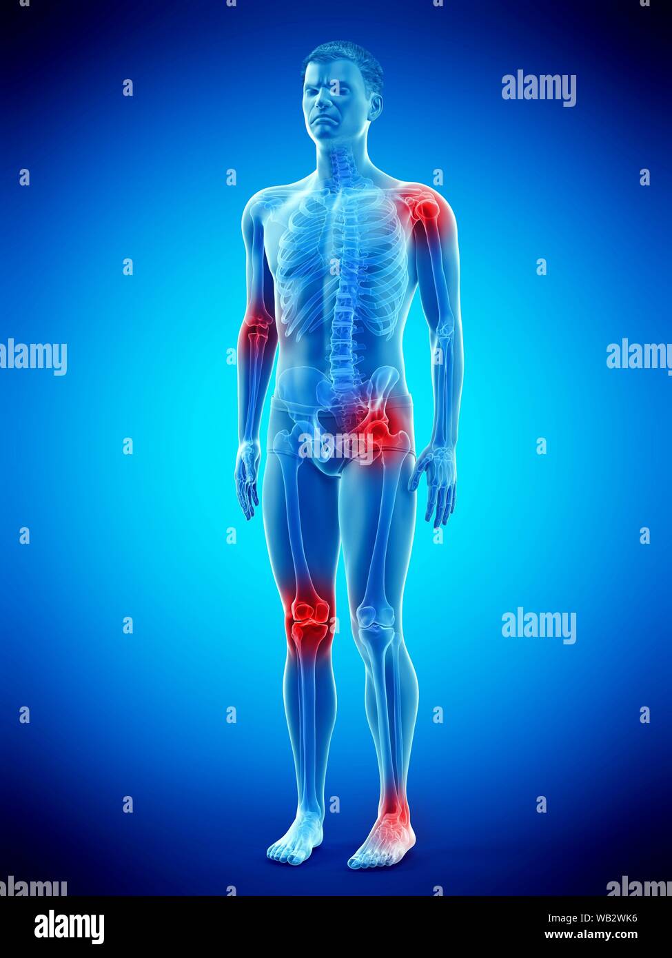 Joint pain, conceptual illustration Stock Photo - Alamy
