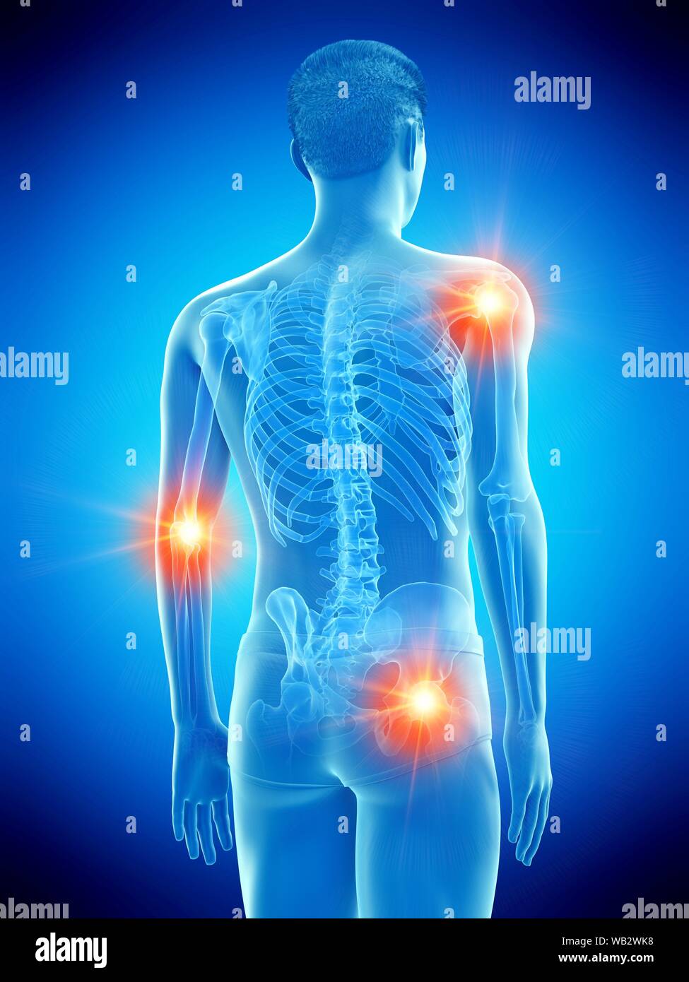 Joint pain, conceptual illustration Stock Photo - Alamy
