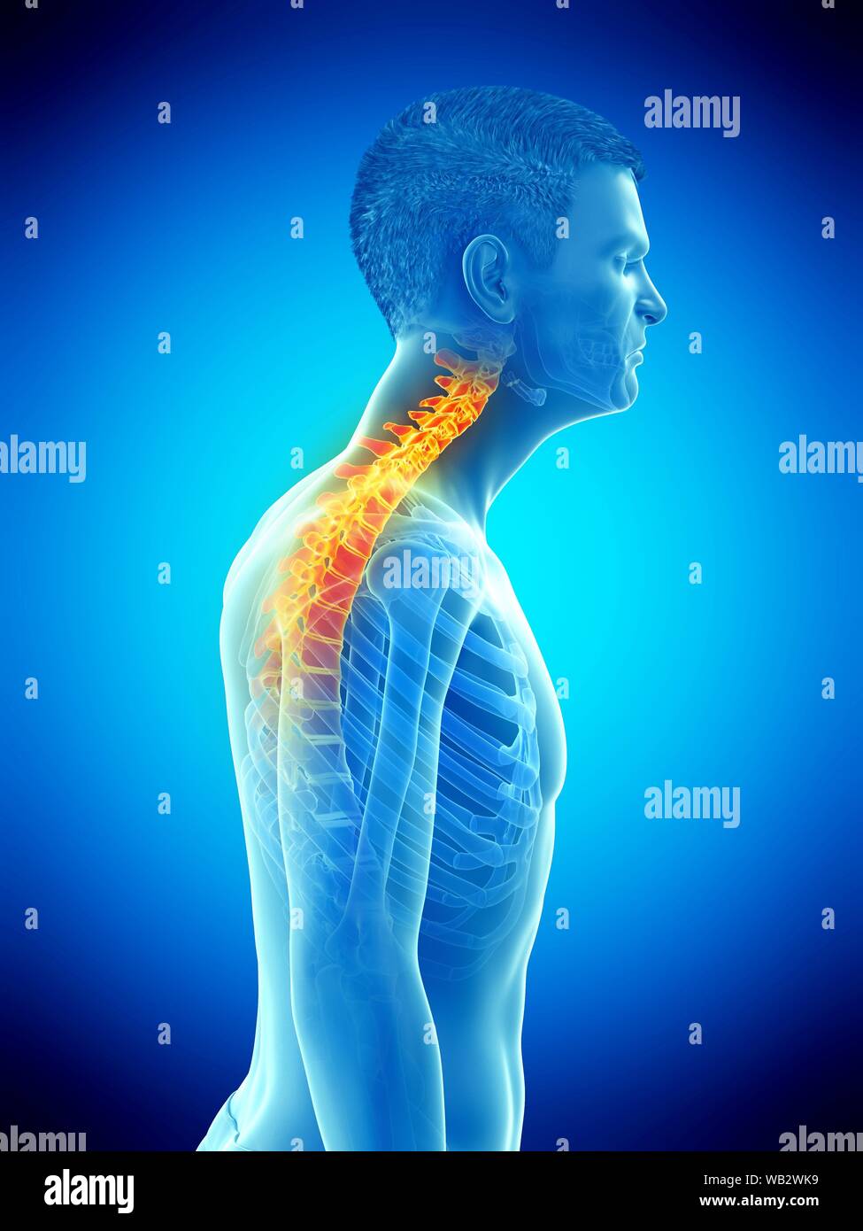 Neck pain, conceptual illustration Stock Photo - Alamy