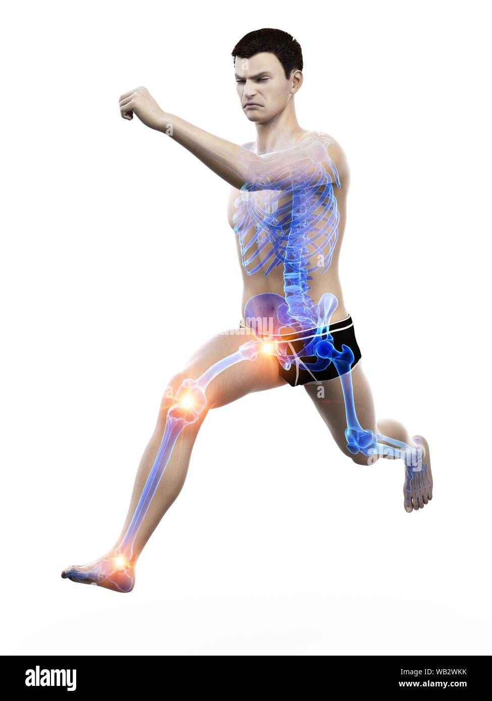 Runner with joint pain, conceptual illustration Stock Photo - Alamy