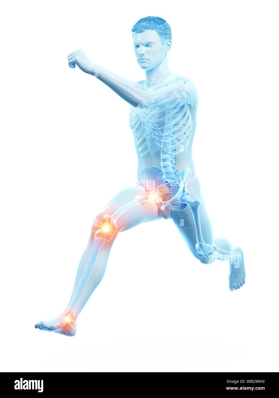 Runner with joint pain, conceptual illustration Stock Photo - Alamy