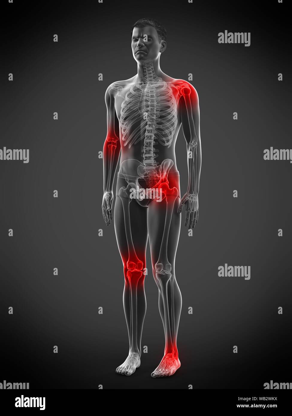 Joint pain, conceptual illustration Stock Photo - Alamy