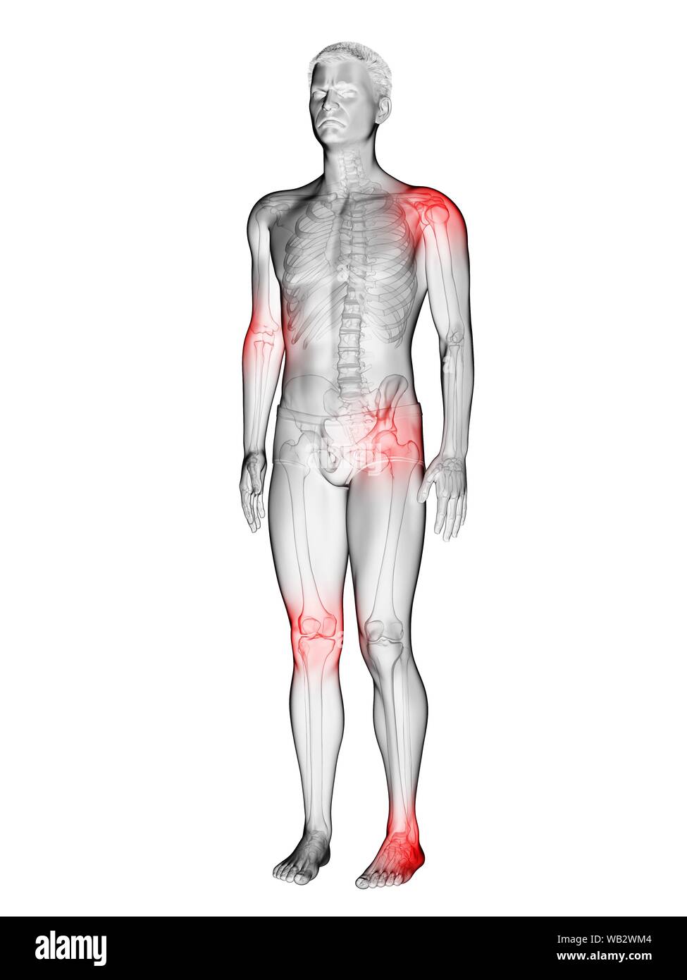 Painful shoulder joint illustration Cut Out Stock Images & Pictures - Alamy