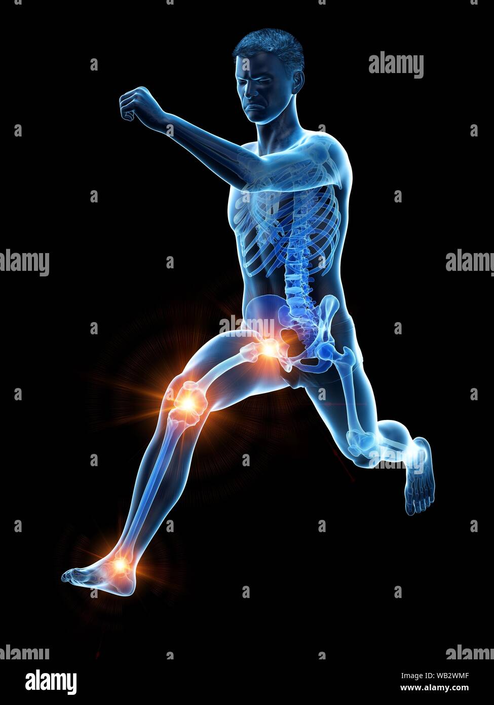Runner with joint pain, conceptual illustration Stock Photo - Alamy
