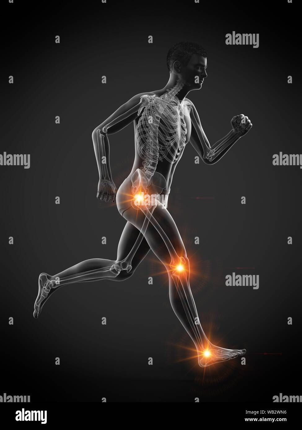 Runner with joint pain, conceptual illustration Stock Photo - Alamy