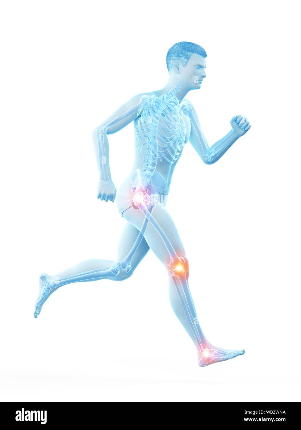 Runner with joint pain, conceptual illustration Stock Photo - Alamy