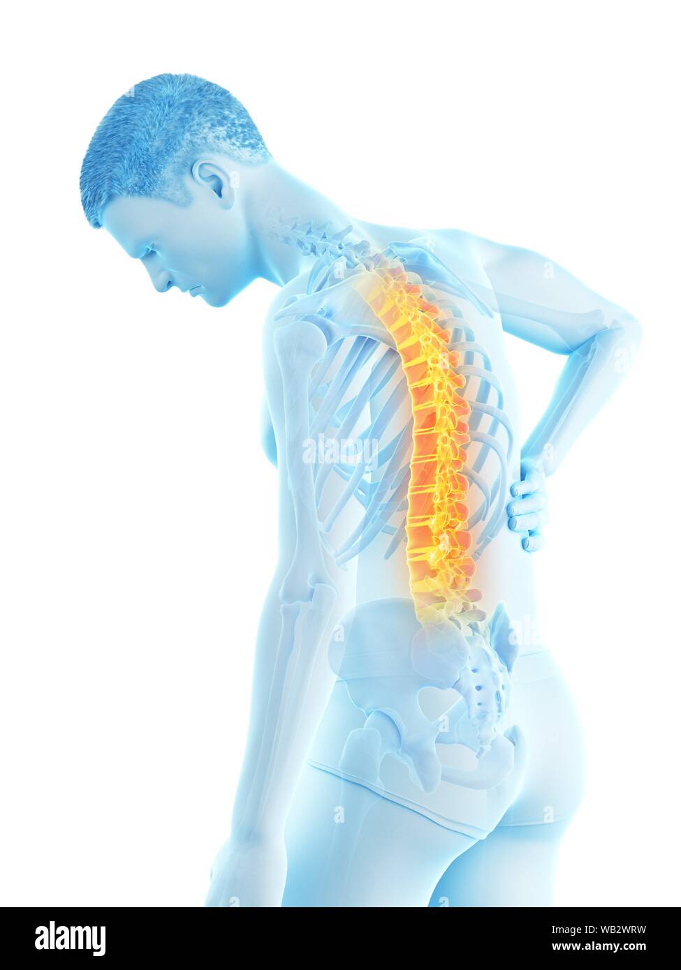 Back pain, conceptual illustration Stock Photo - Alamy