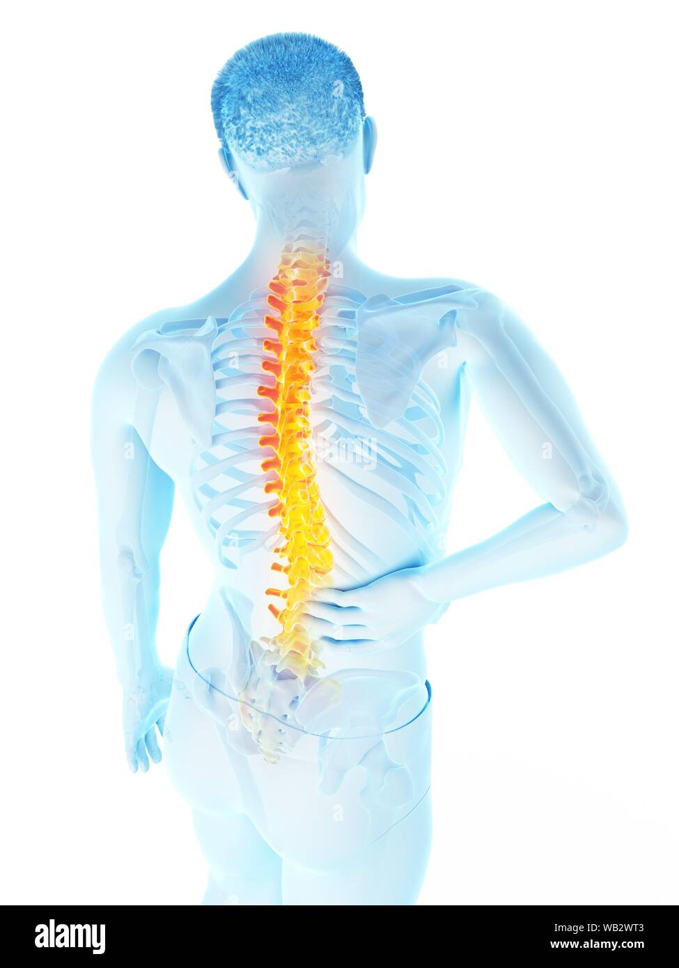 Back pain, conceptual illustration Stock Photo - Alamy