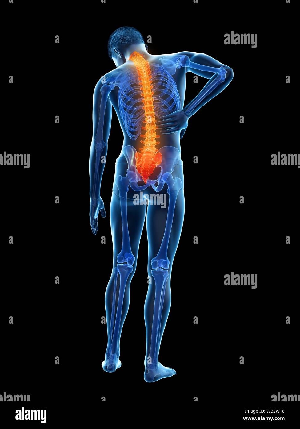 Back pain, conceptual illustration Stock Photo - Alamy