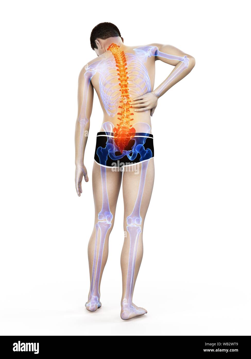 Back pain, conceptual illustration Stock Photo - Alamy