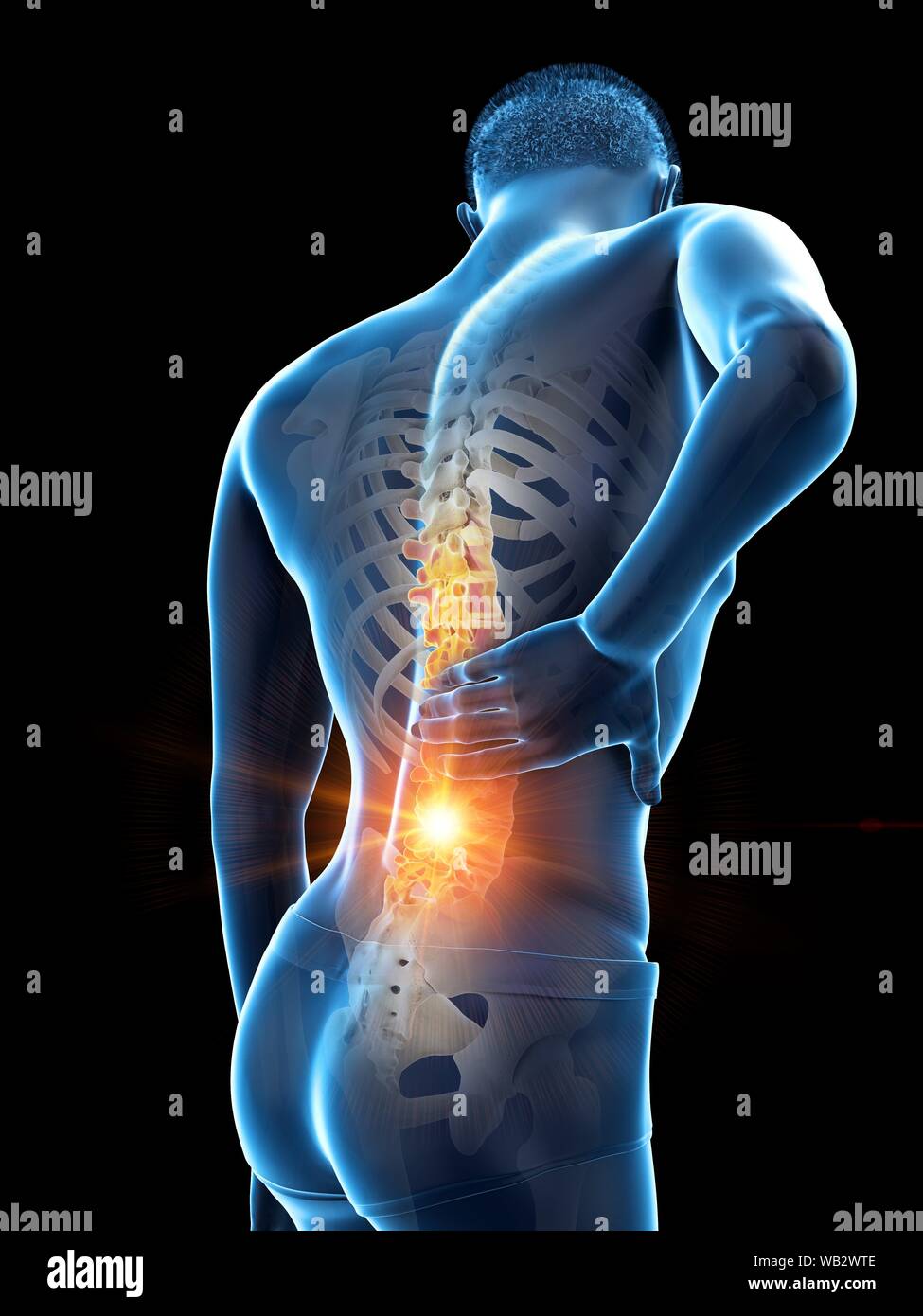 Back pain, conceptual illustration Stock Photo - Alamy