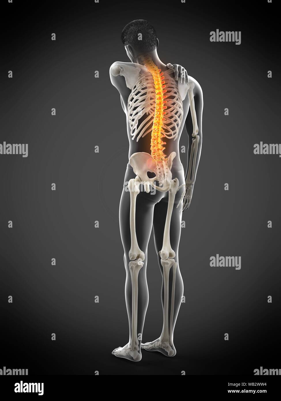 Back pain, conceptual illustration Stock Photo - Alamy