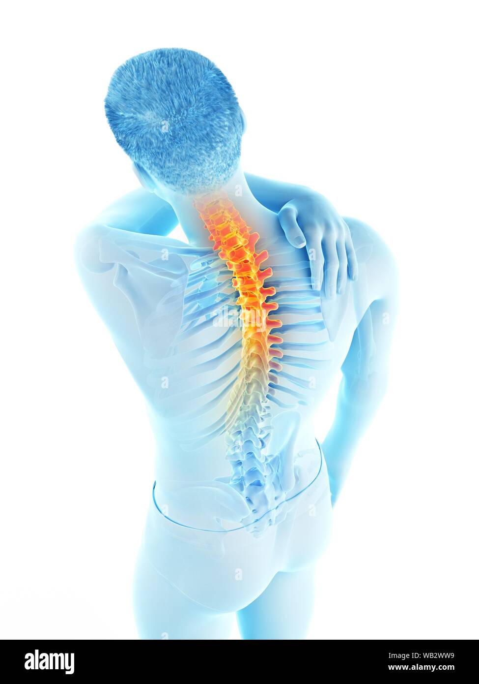 Back pain, conceptual illustration Stock Photo - Alamy