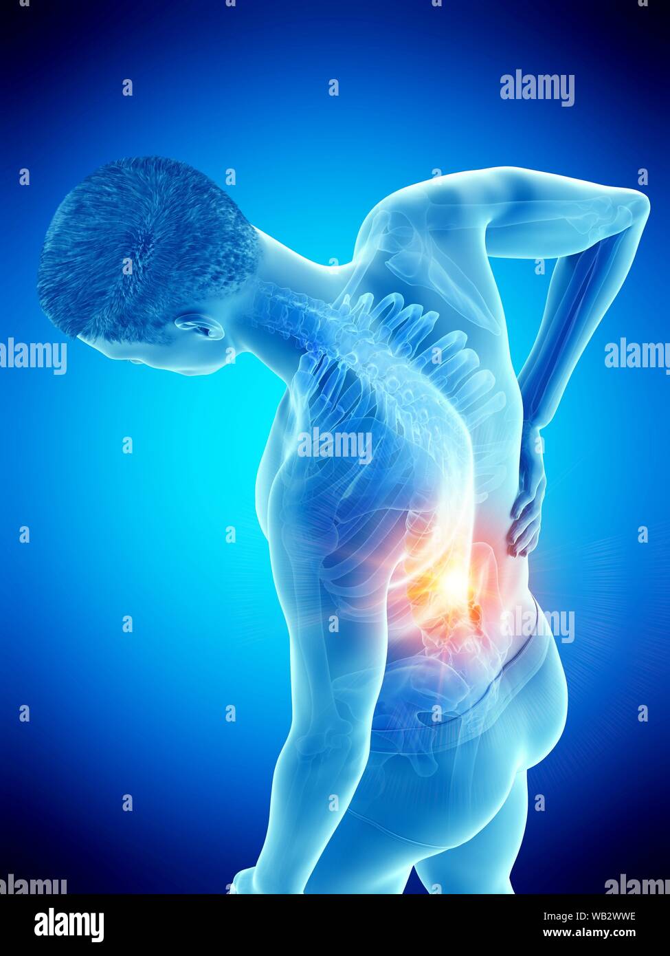 Back pain, conceptual illustration Stock Photo - Alamy