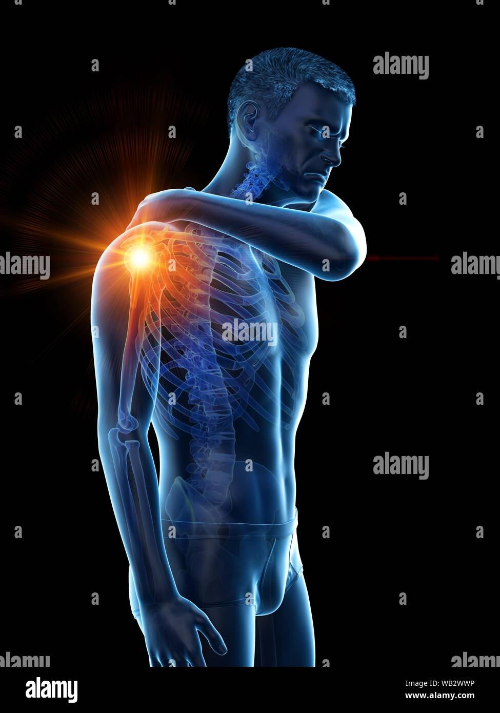 Shoulder pain, conceptual illustration Stock Photo - Alamy