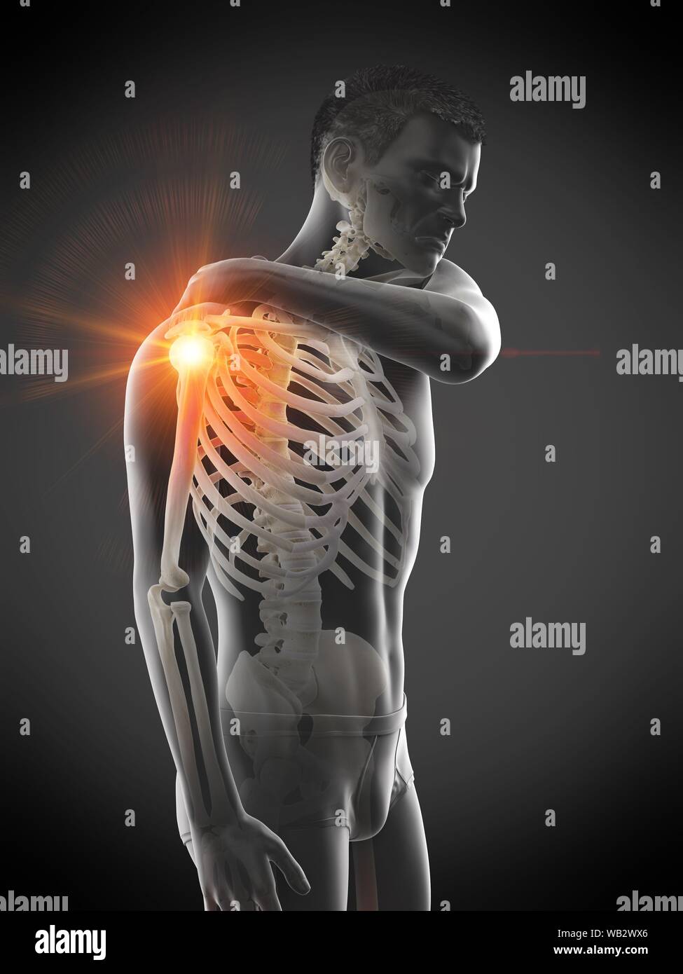 Shoulder pain, conceptual illustration Stock Photo - Alamy Shoulder pain, conceptual illustration Stock Photo - Alamy